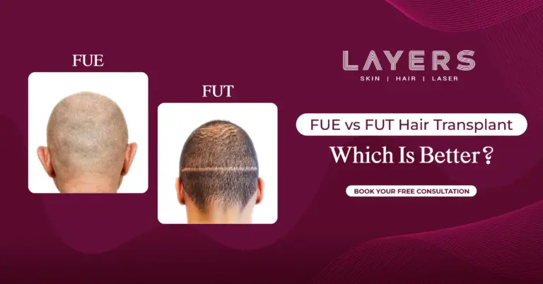 FUE vs FUT Hair Transplant in Hyderabad | Layers Clinics